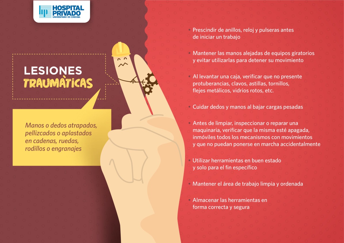 Accidentes en manos